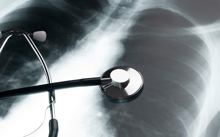 AARC Approved CEUs for Respiratory Therapy | Continued.com